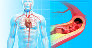 Understanding the Carotid Arteries: Anatomy, Function, and Disease - Dr ...